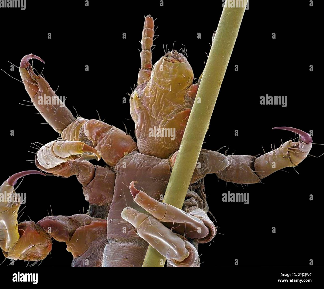Head louse, SEM Stock Photo - Alamy