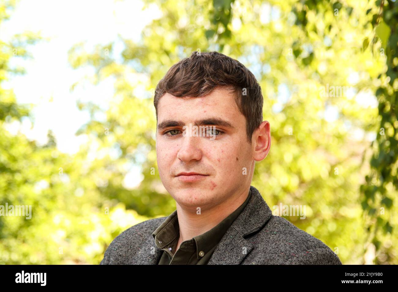 A young man in his 20s standing outside in nature, with visible acne ...