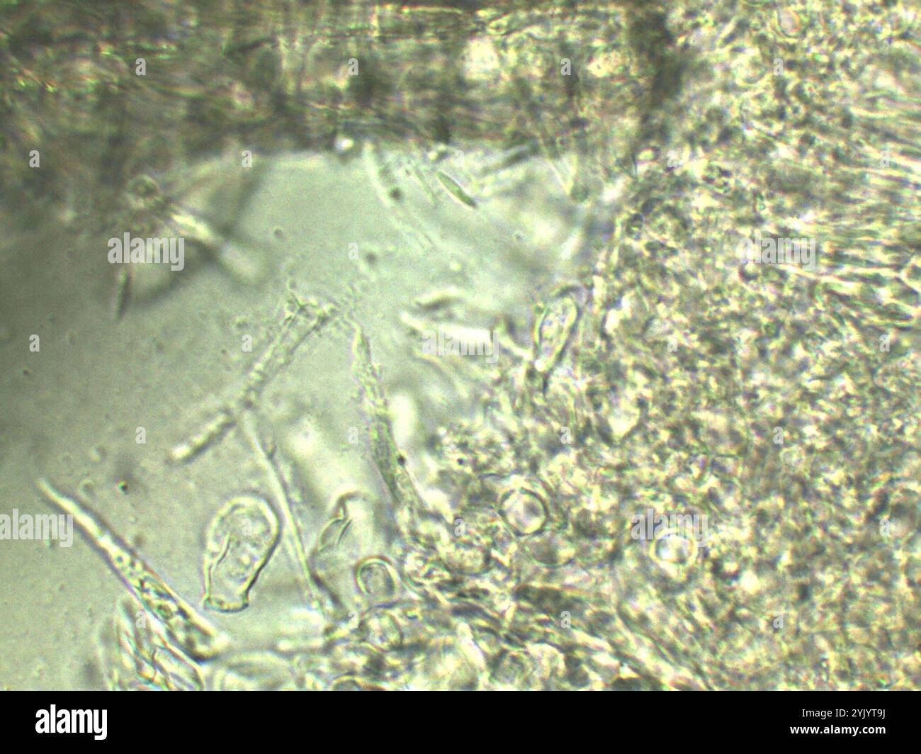 Orbilia hi-res stock photography and images - Alamy