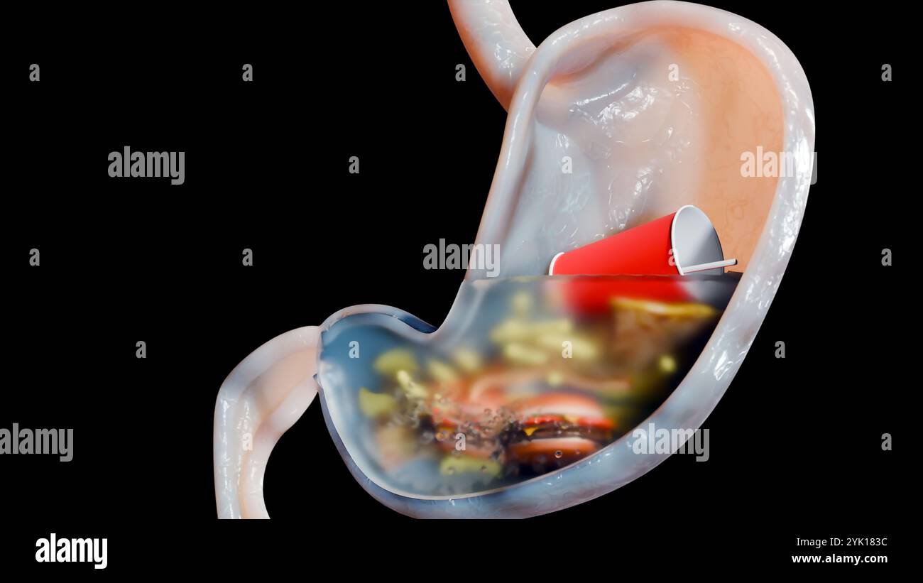 Stomach with Junk food, unhealthy hamburger and pizza and fries ...