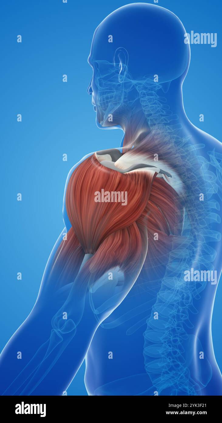 Pain damage in shoulder muscles hi-res stock photography and images - Alamy