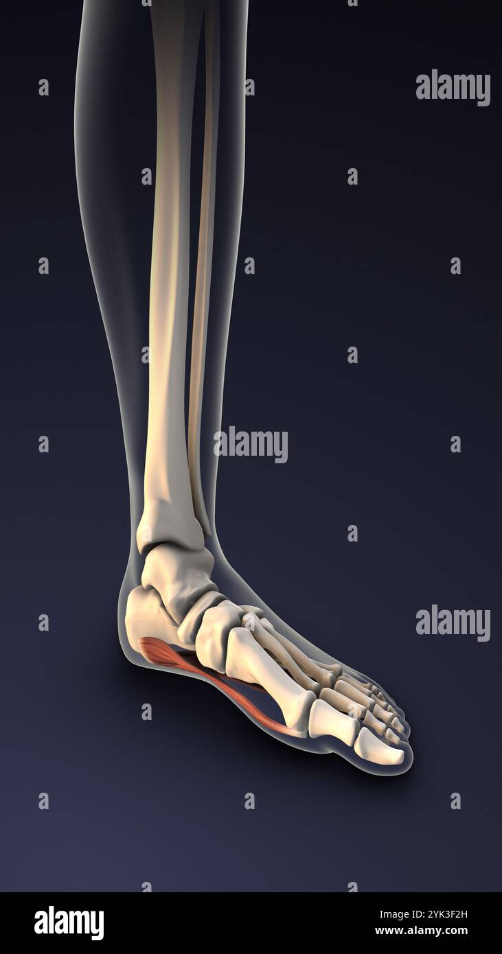 Plantar Fascia Ligament Overstrain and Dysfunction Stock Photo - Alamy