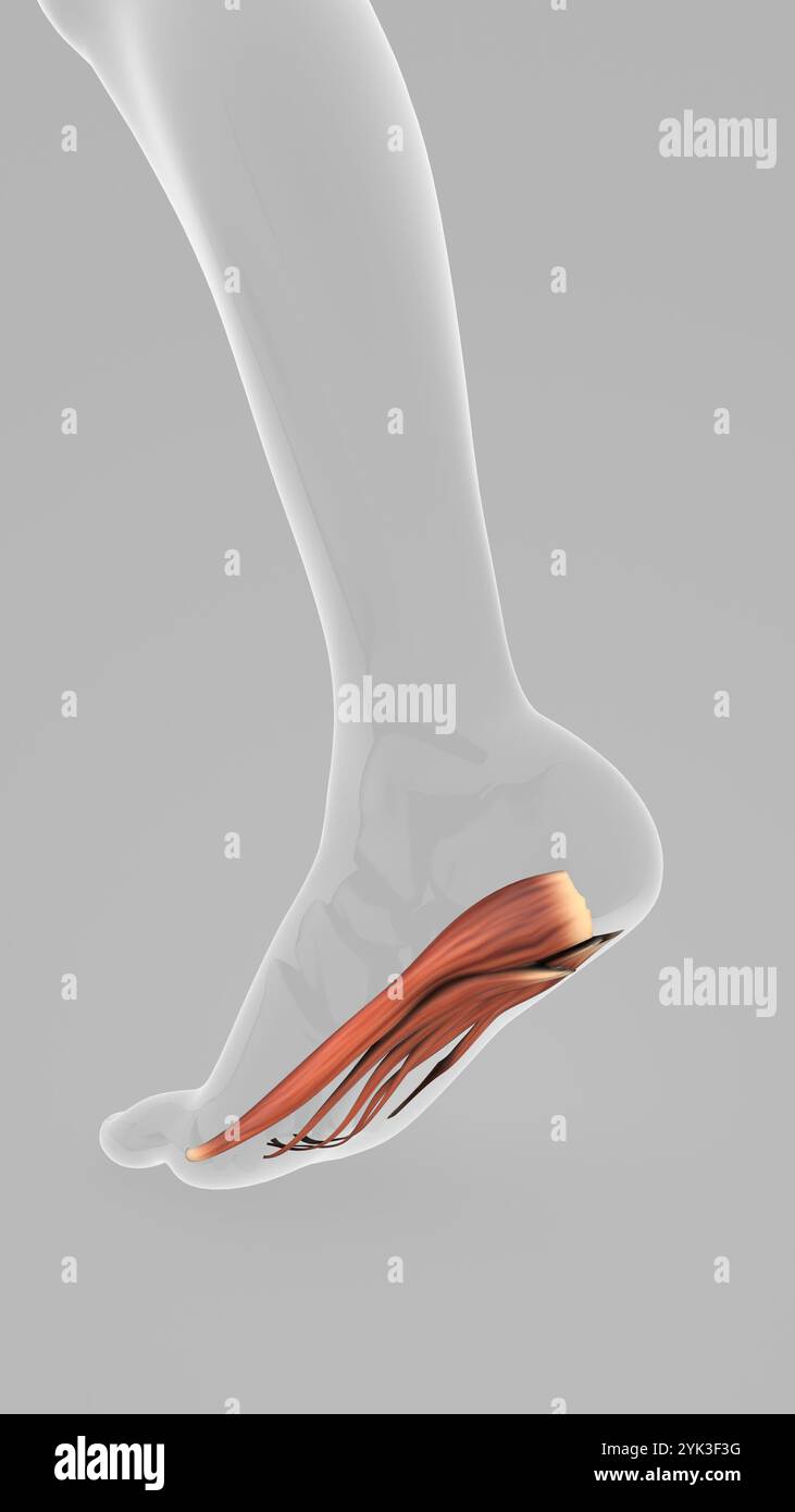 Plantar Fascia Tissue Overload Dysfunction Disorder Stock Photo - Alamy