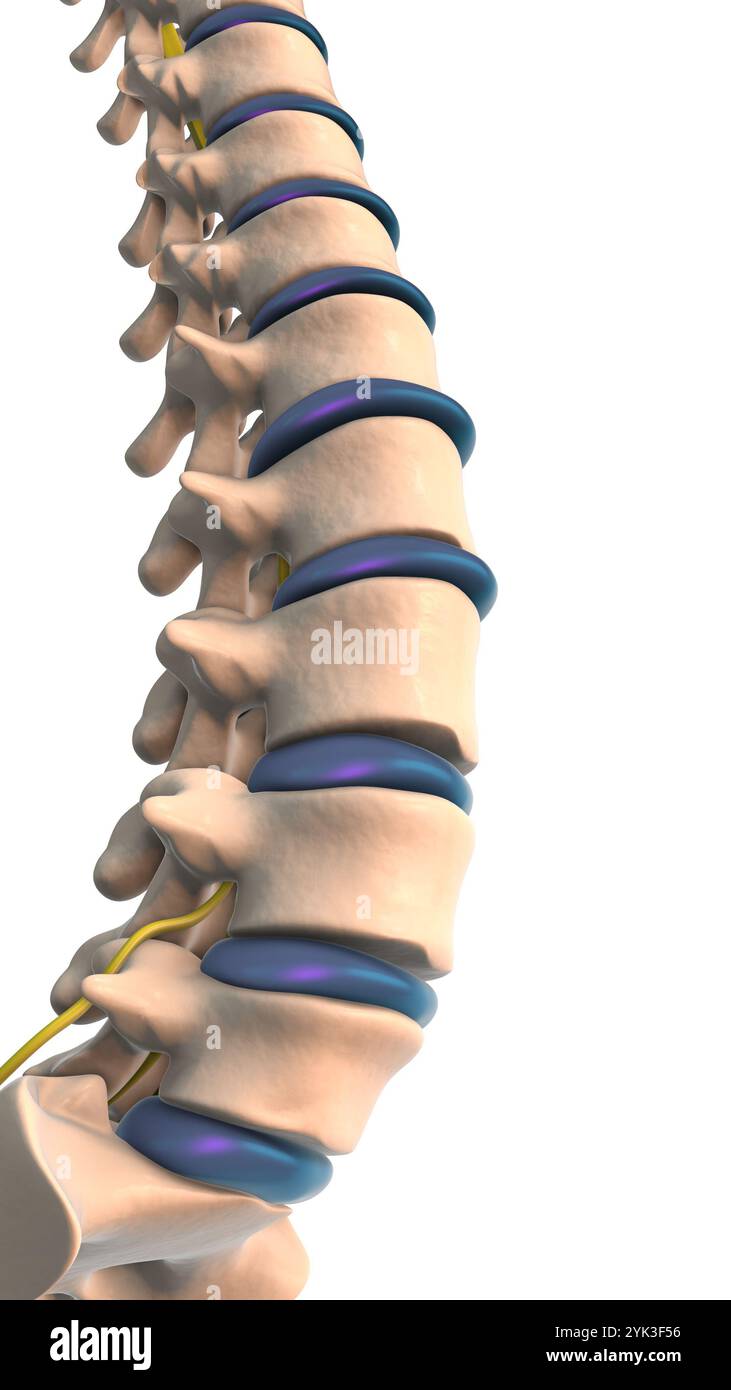 Ruptured disk hi-res stock photography and images - Alamy