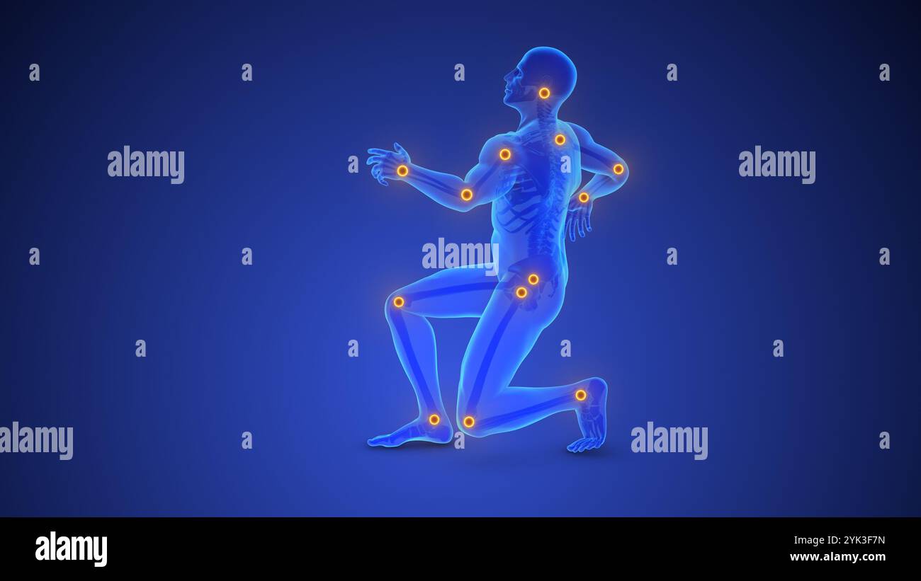 Chronic Pain in Multiple Body Joints Stock Photo - Alamy