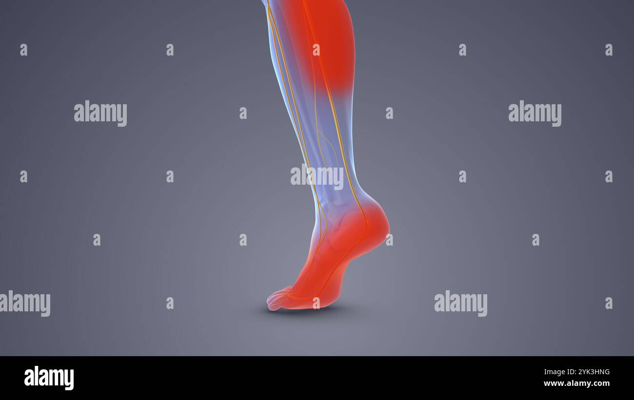 Sciatic Nerve Compression Affecting Blood Flow Circulation Stock Photo ...