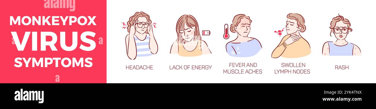 Signs of monkeypox include various symptoms. A comprehensive visual depiction is essential for ...