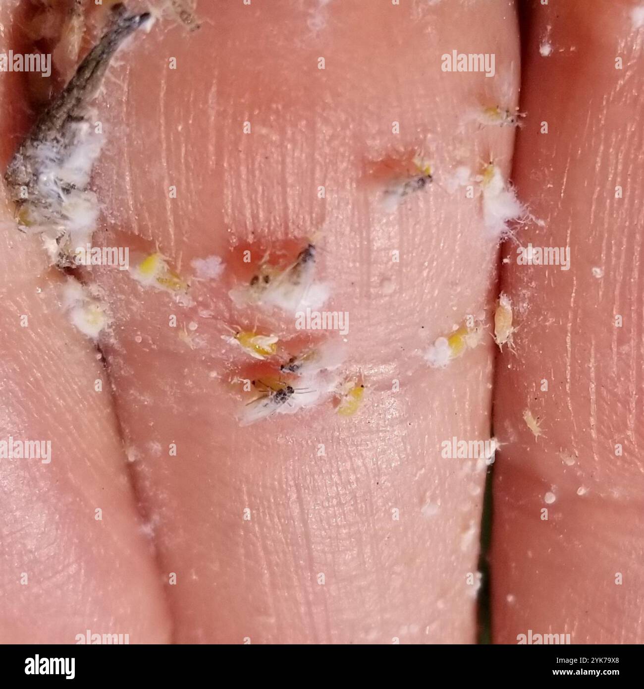 Woolly Aphids and Gall-making Aphids (Eriosomatinae Stock Photo - Alamy