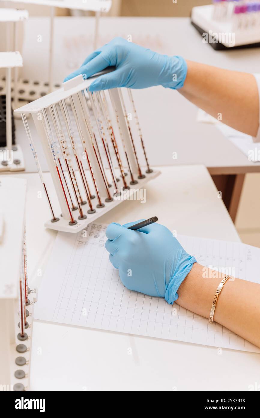 Labanalysis hi-res stock photography and images - Alamy