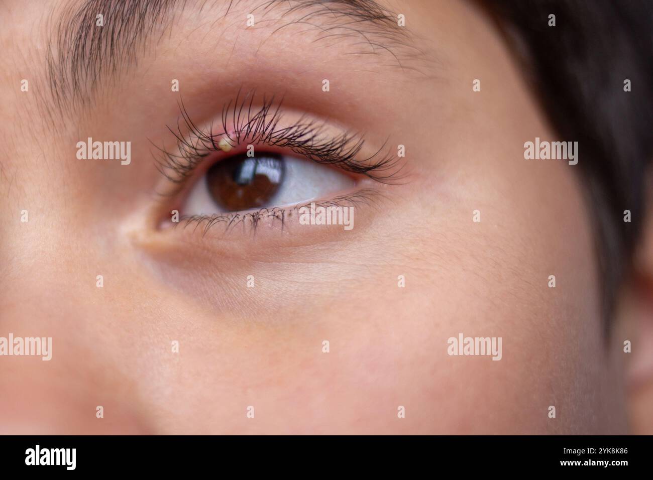 Eyelid anatomy hi-res stock photography and images - Alamy