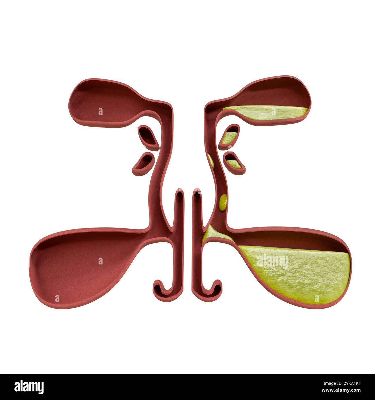 Sinuses and nasal cavity hi-res stock photography and images - Alamy