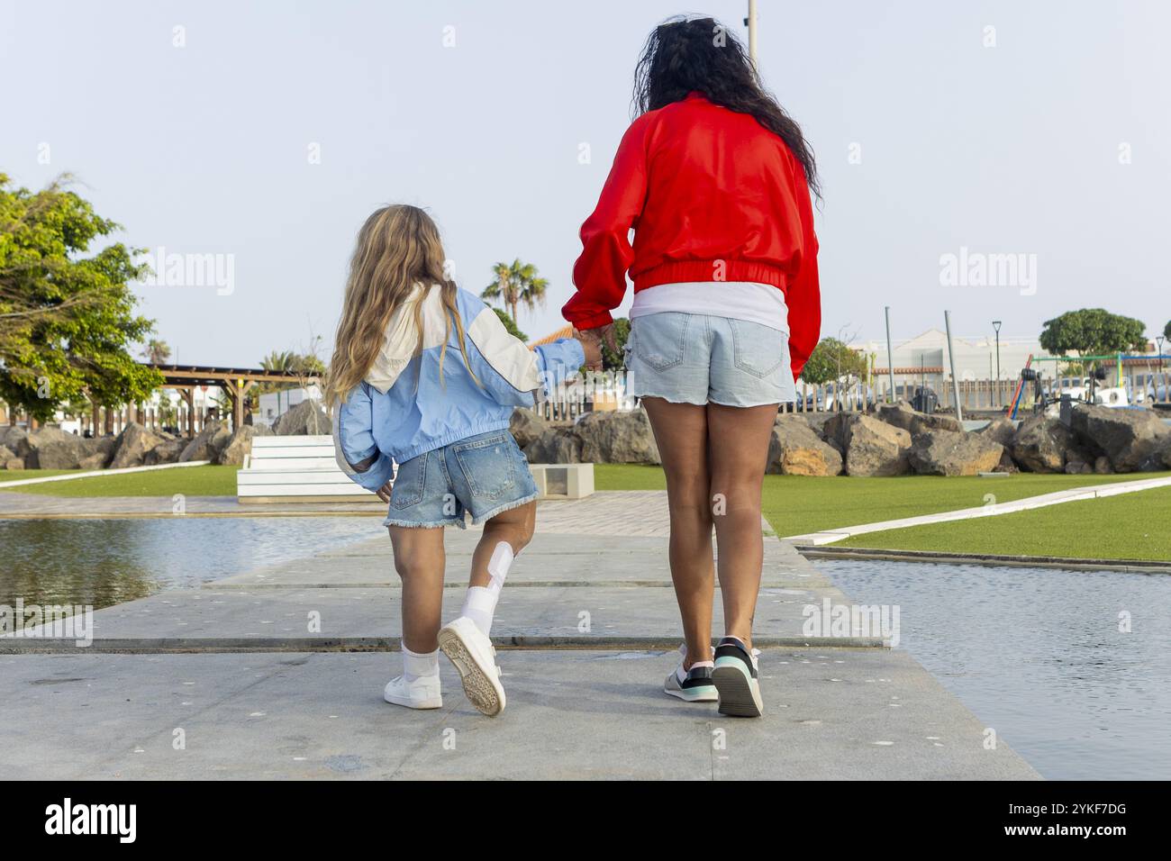 A girl with Stuve-Wiedemann syndrome, in which medical patches are seen ...