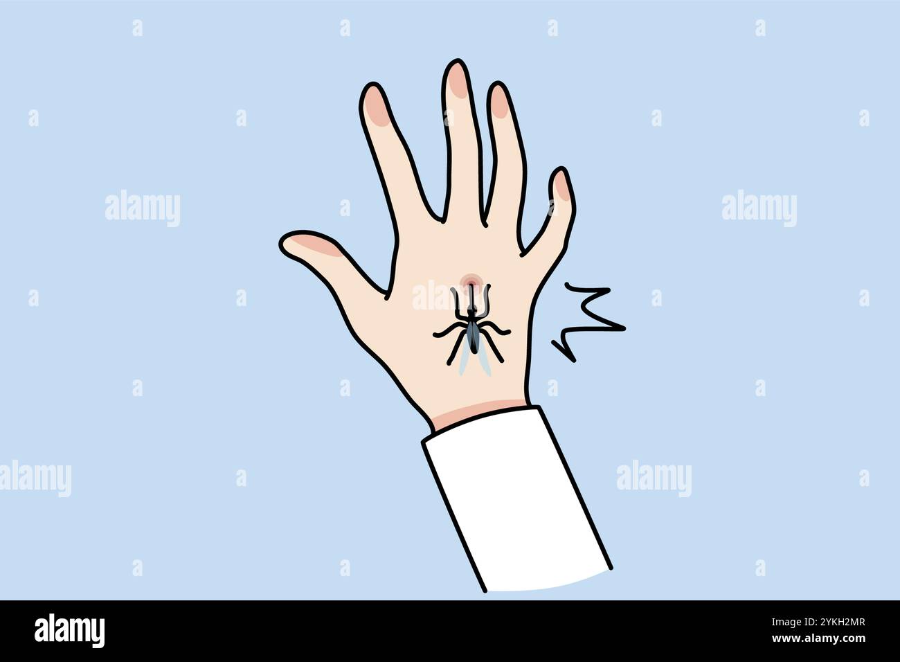 Close up of mosquito bite hand. Bug or insect biting person leave spot ...