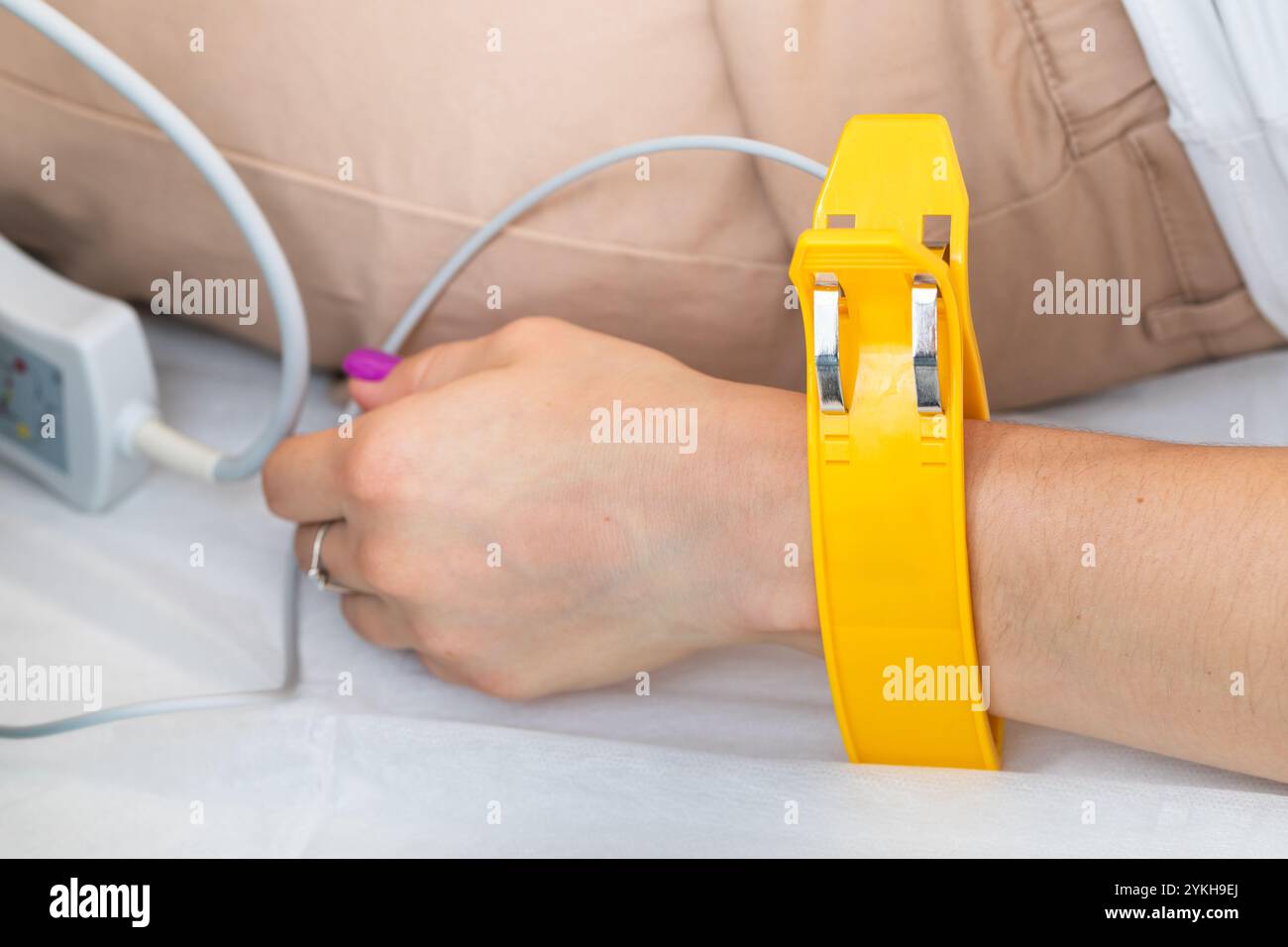 Close-up of yellow electrode clamp secured on a patient's arm for an ...