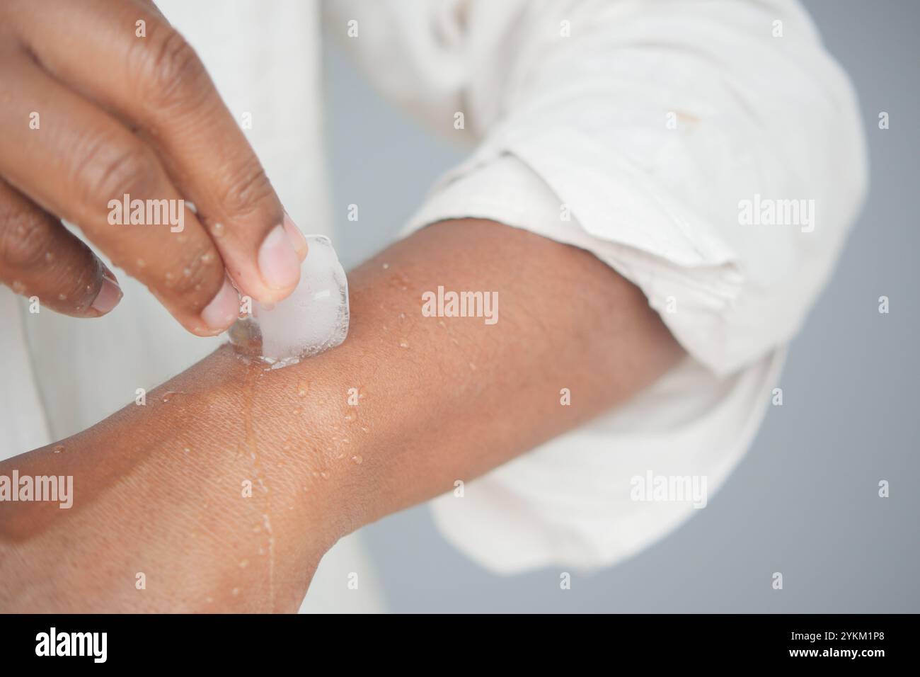 Ice cube on wrist hi-res stock photography and images - Alamy