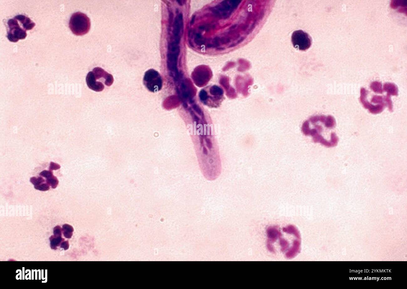 Brugia malayi (03 Stock Photo - Alamy