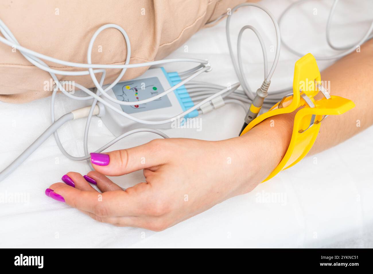 Close-up of yellow electrode clamp secured on a patient's arm for an ...