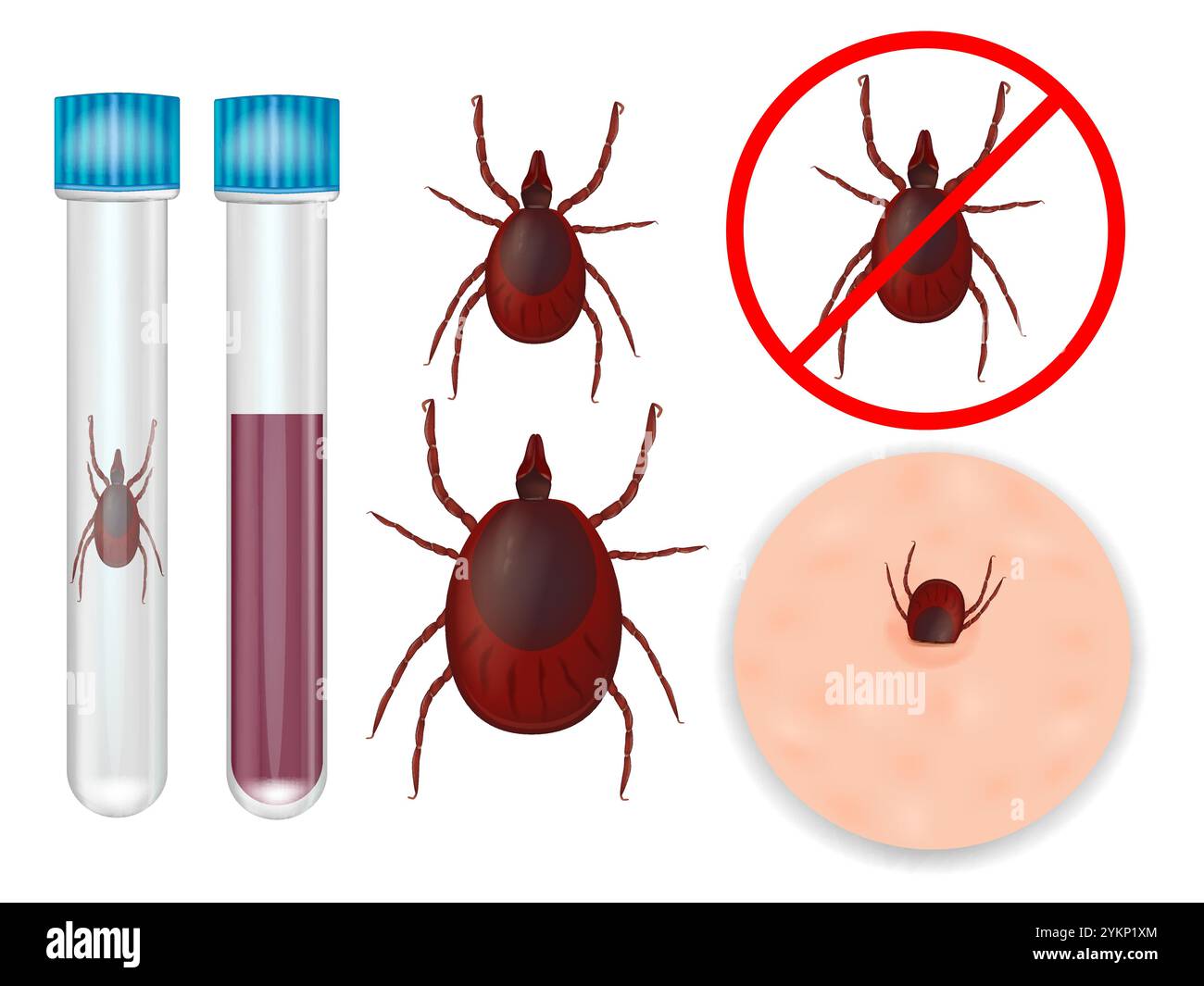 Ixodida or tick. Tick-borne encephalitis and Lyme borreliosis ...