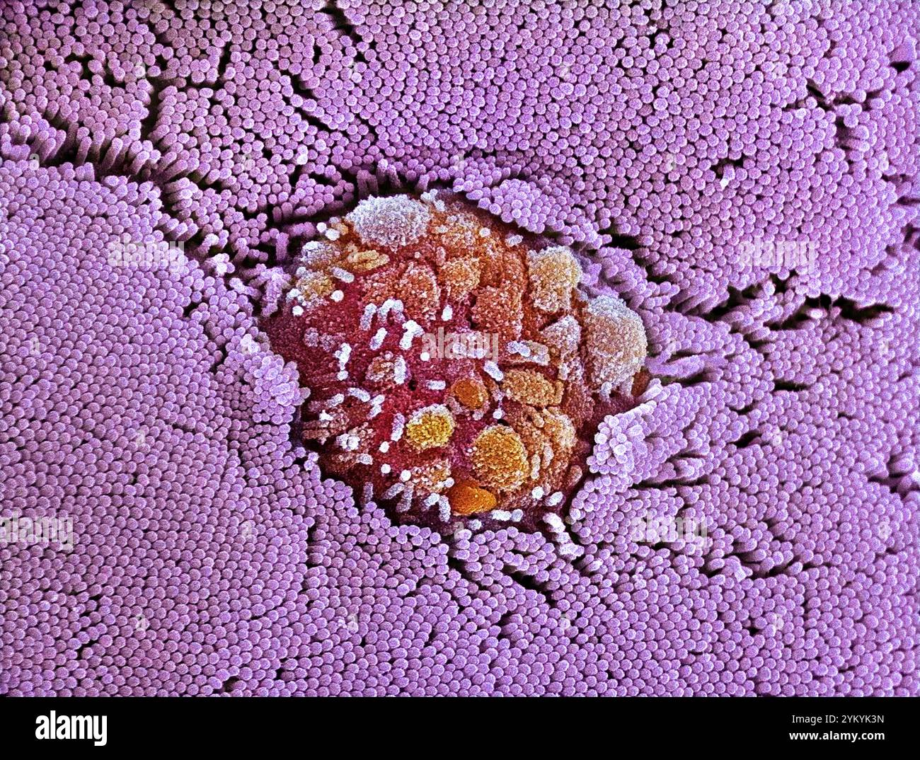 Intestinal microvilli. Coloured scanning electron micrograph (SEM) of ...