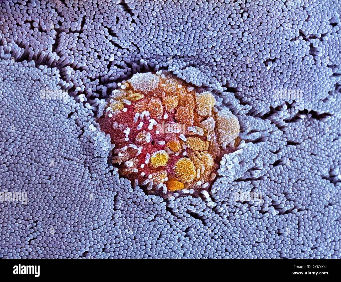 Intestinal microvilli. Coloured scanning electron micrograph (SEM) of ...