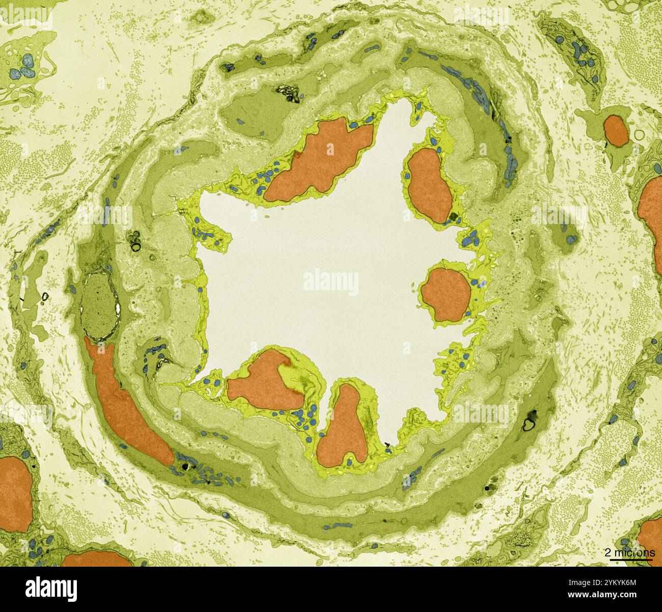 Coloured transmission electron micrograph (TEM) of an arteriole (small ...