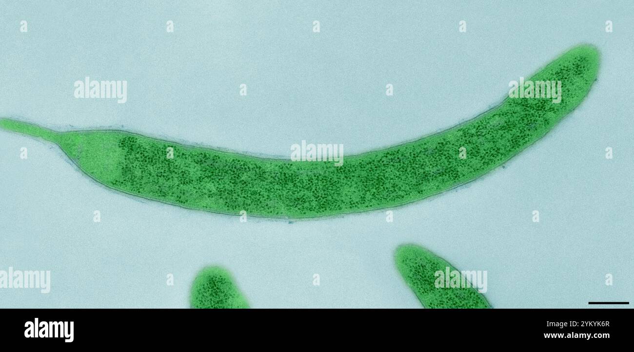 Archaea and bacteria, TEM Stock Photo - Alamy