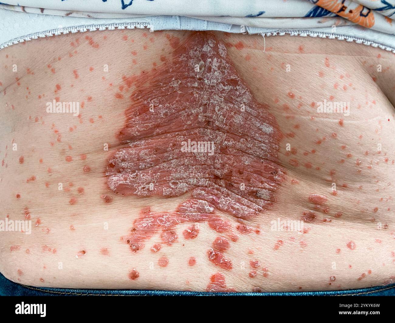 Caulobacter crescentus bacterium, TEM Stock Photo - Alamy