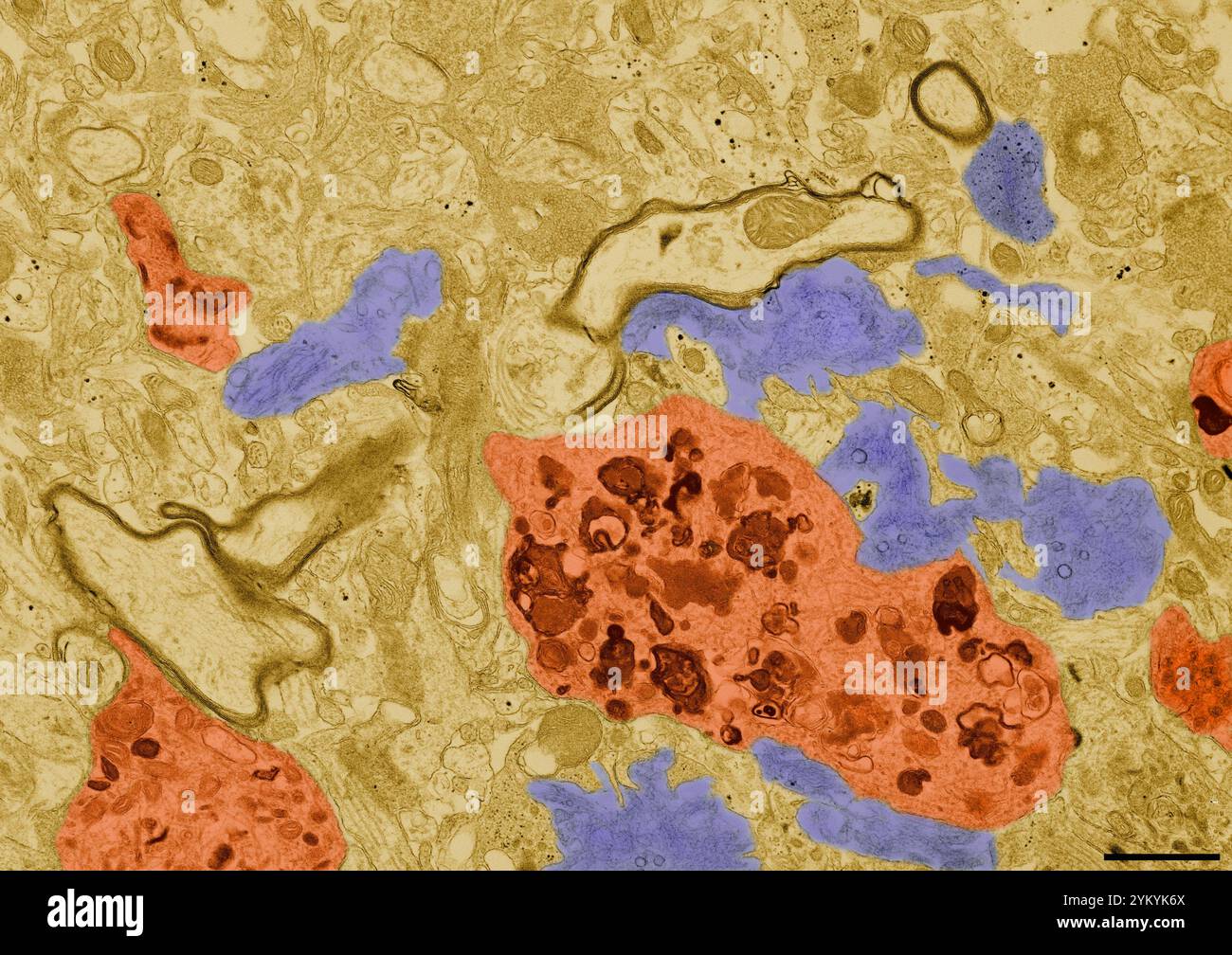 Coloured transmission electron micrograph (TEM) of a section through ...