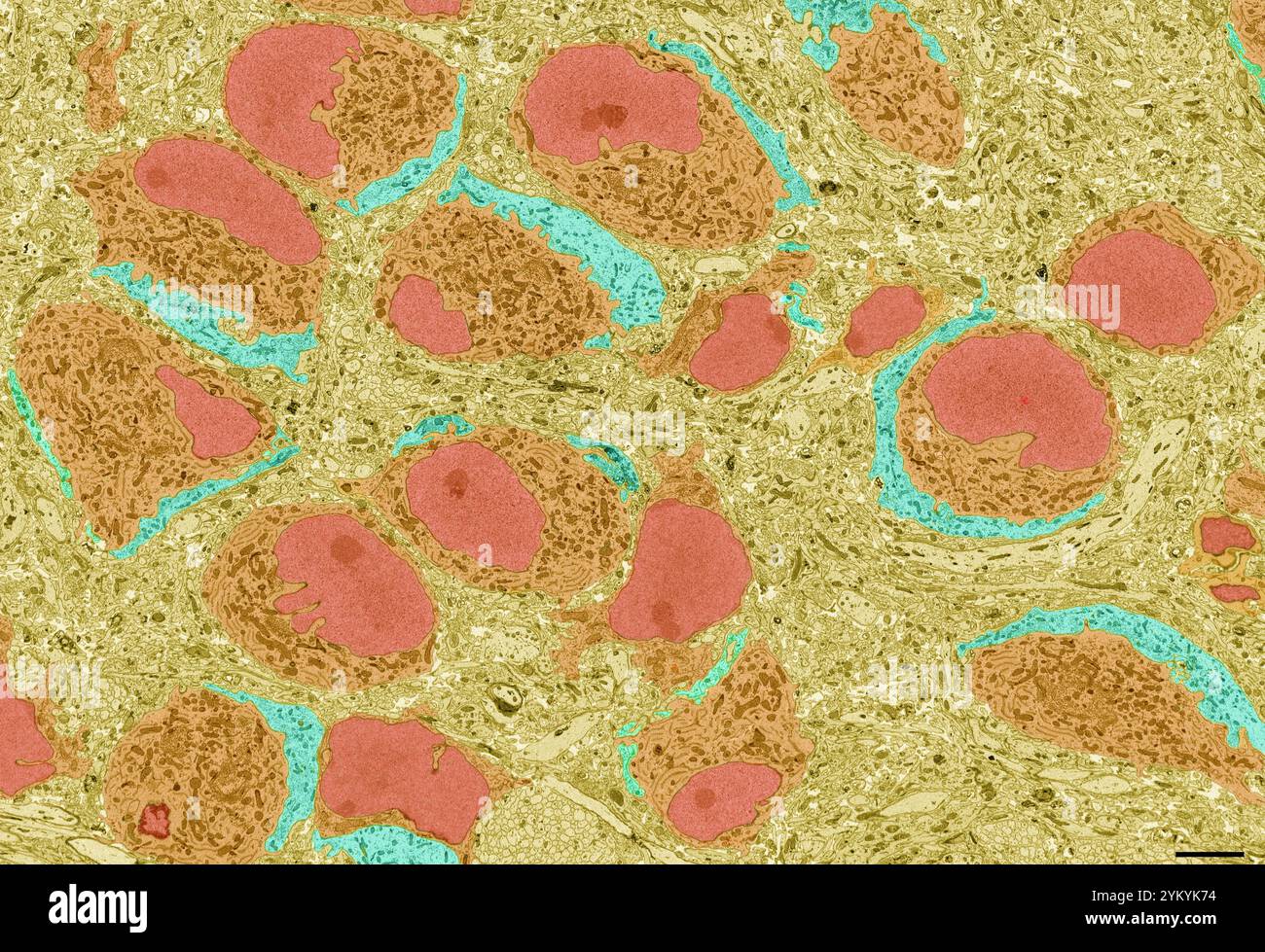Coloured transmission electron micrograph (TEM) of neurons (nerve cells ...