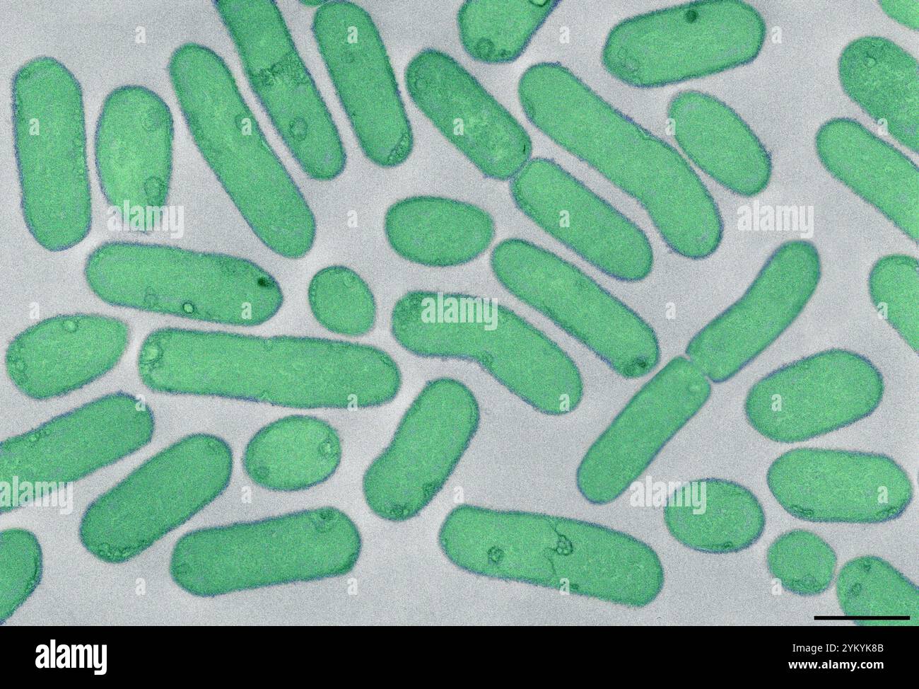 Coloured transmission electron micrograph (TEM) of Listeria ...