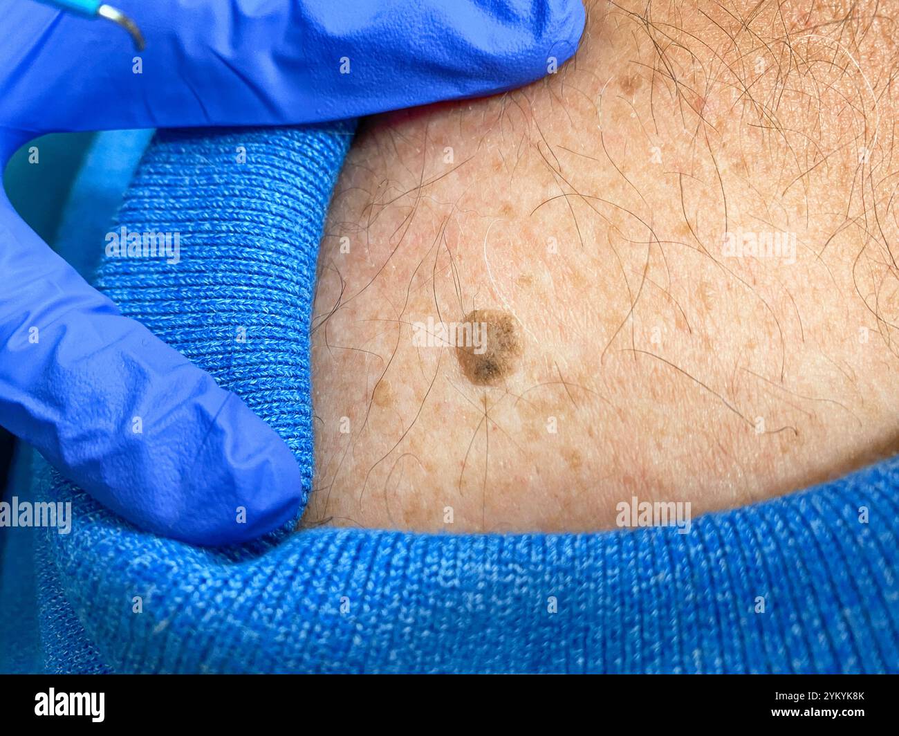 Nuclear pore complexes, TEM Stock Photo - Alamy