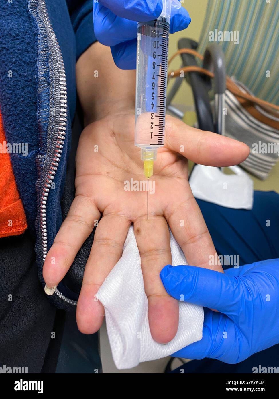 Digital nerve block. Doctor injecting local anaesthetic into a patient ...