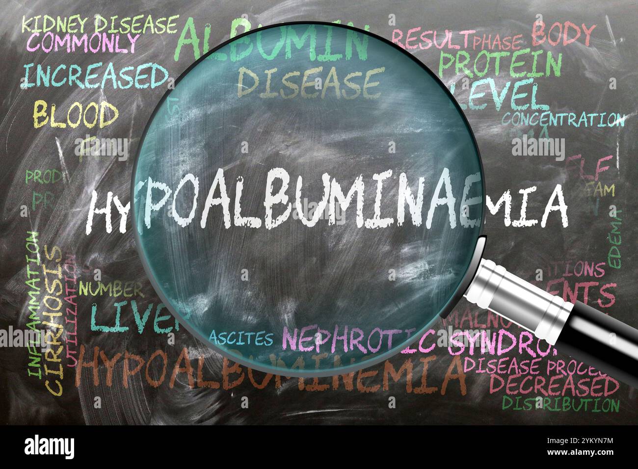 Hypoalbuminaemia symbol hi-res stock photography and images - Alamy