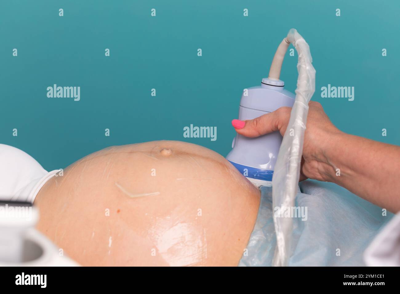 Sonographer scanning pregnant woman's abdomen with ultrasonic ...