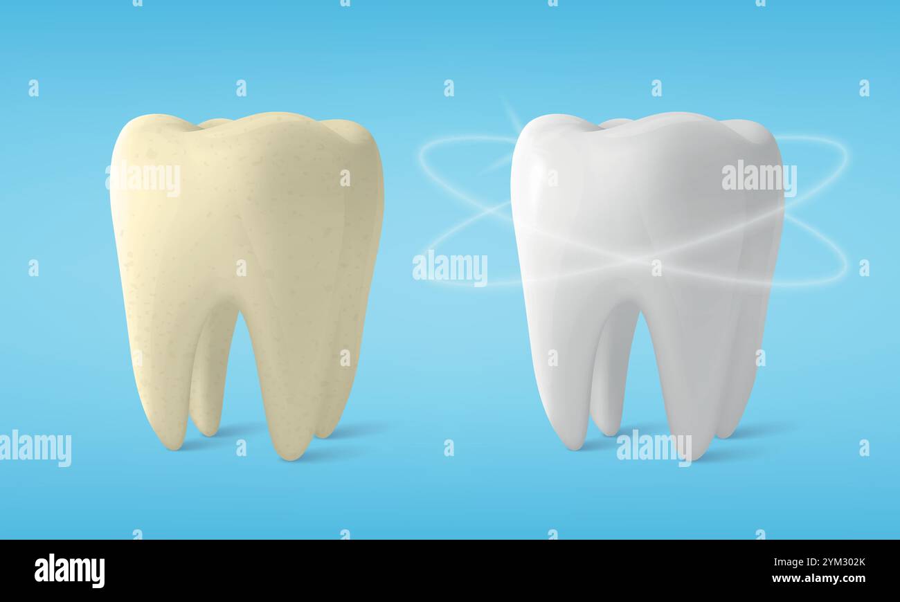 Vector Banner with Realistic Dirty and Clean Tooth. Cleaning Concept ...
