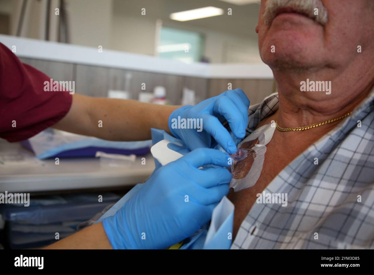 Implantable port hi-res stock photography and images - Alamy