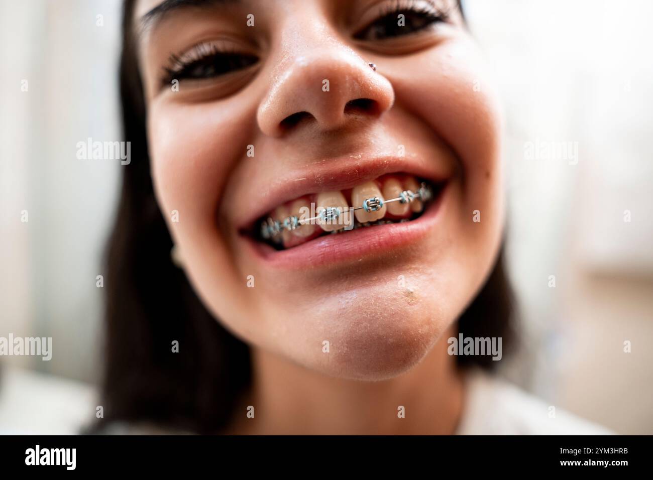smiling brunette teenage girl with orthodontic dentures Stock Photo - Alamy
