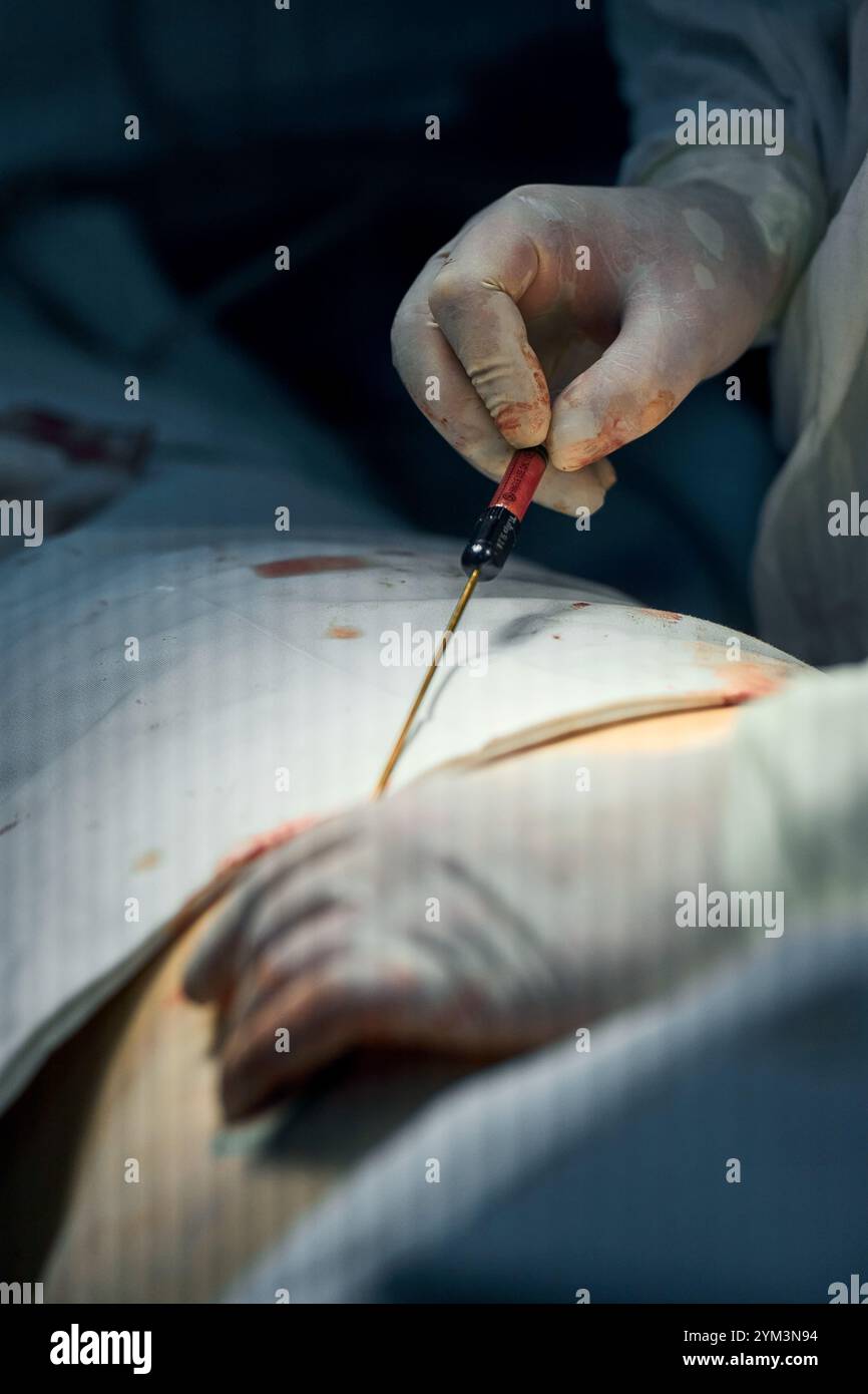 Close up hands surgical team hi-res stock photography and images - Alamy