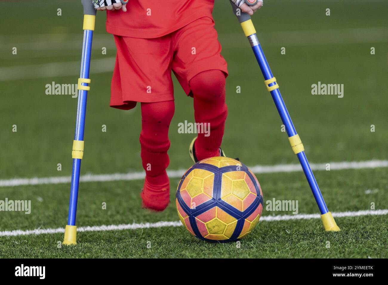 Legs of disabled football plaer with ball and crutches Stock Photo - Alamy