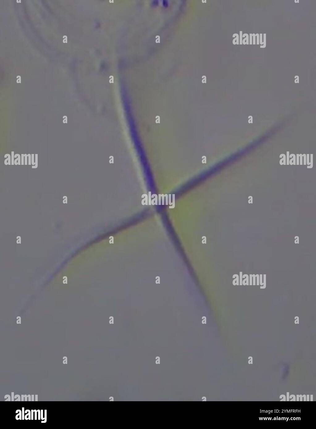 Ankistrodesmus hi-res stock photography and images - Alamy