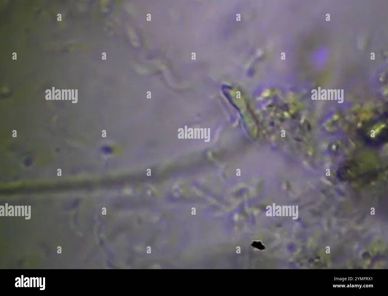 Spirillum hi-res stock photography and images - Alamy