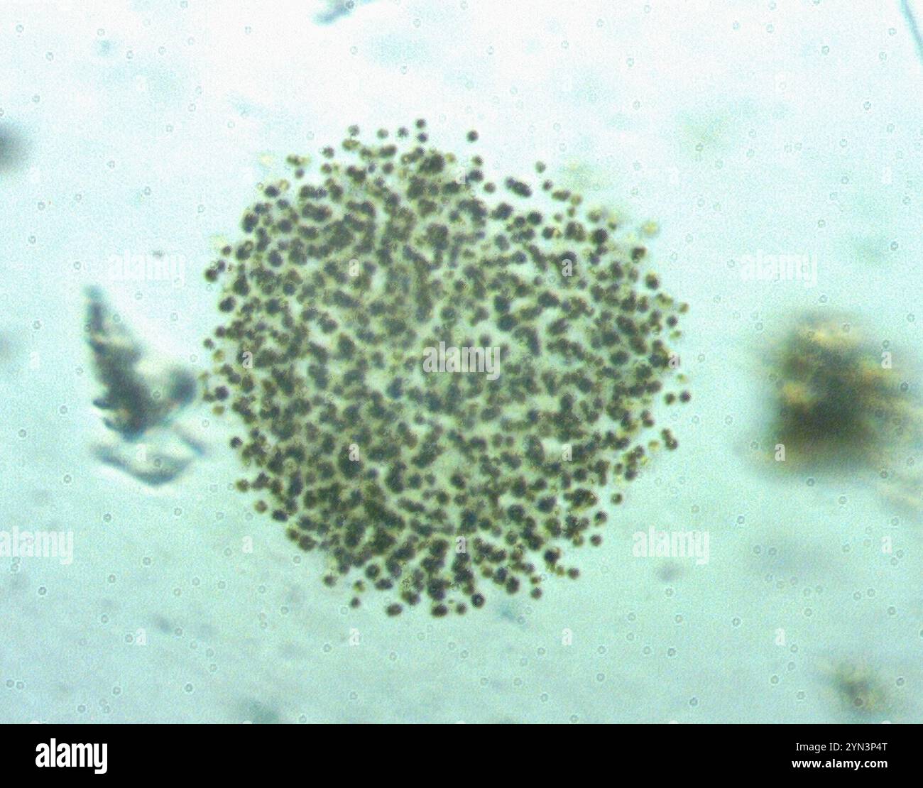 Microcystis aeruginosa hi-res stock photography and images - Alamy