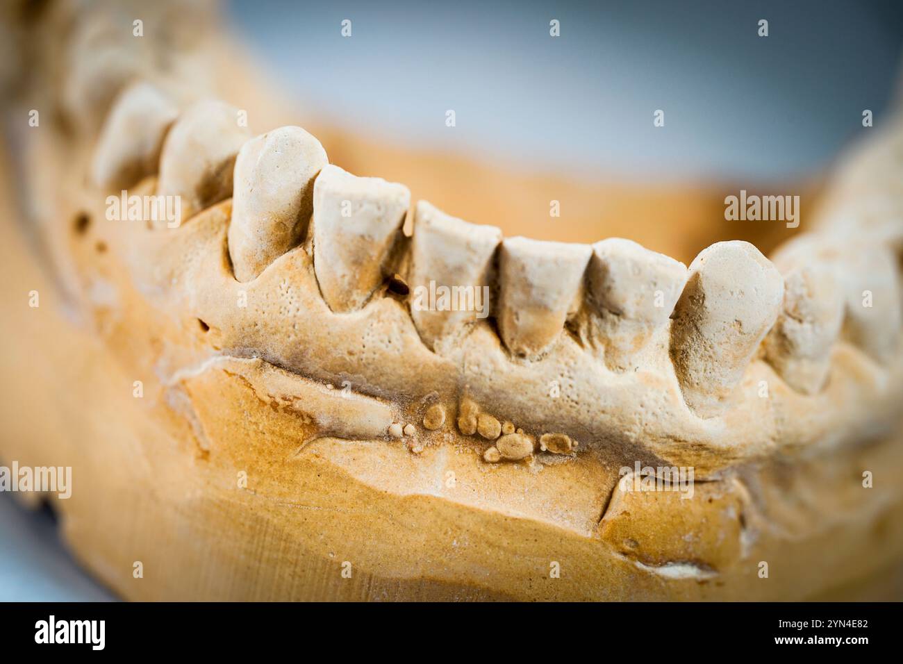 Protesis dental hi-res stock photography and images - Alamy