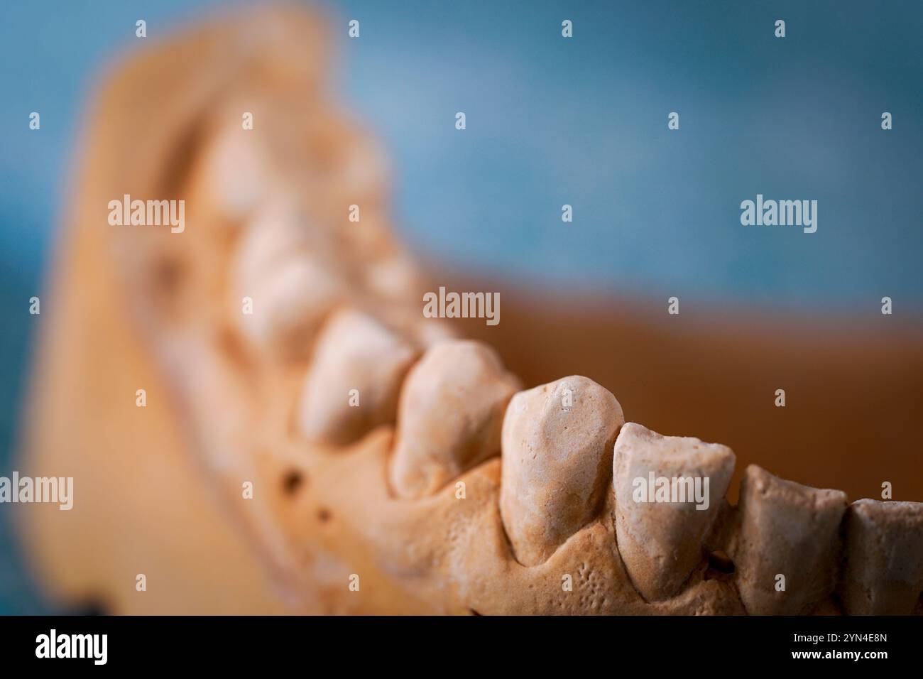 Object image of a medical dental impression Stock Photo - Alamy