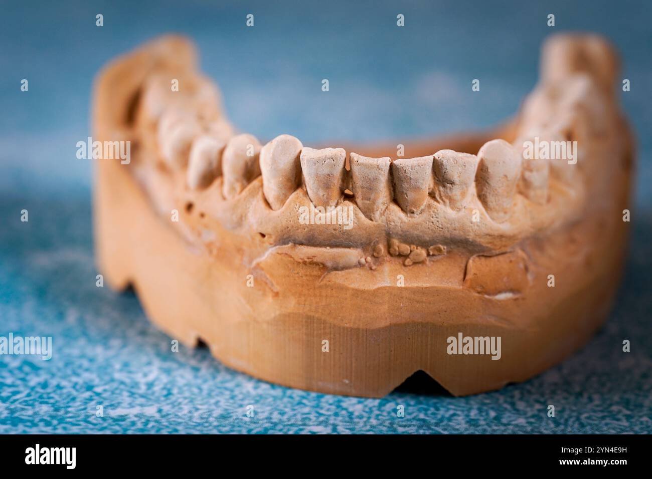 Object image of a medical dental impression Stock Photo - Alamy