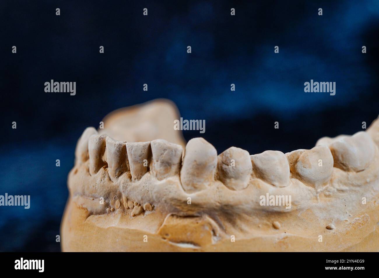 Object image of a medical dental impression Stock Photo - Alamy