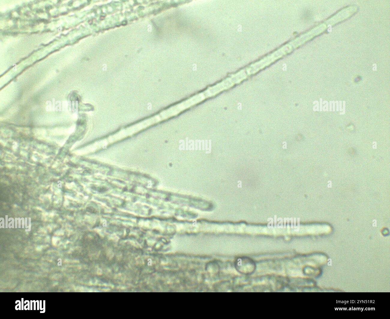 Ascomycete Fungi (Ascomycota Stock Photo - Alamy