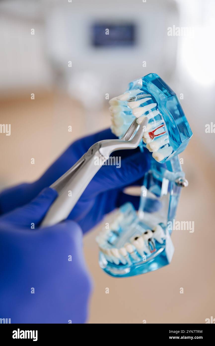 Dentist demonstrating tooth extraction using a transparent jaw model in ...