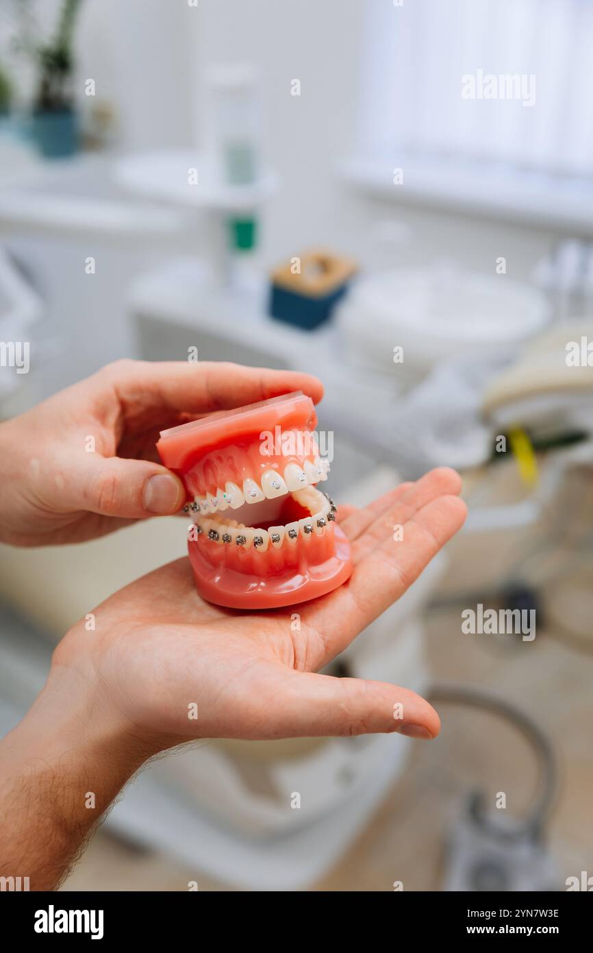 Hand displaying orthodontic teeth model with braces for dental ...