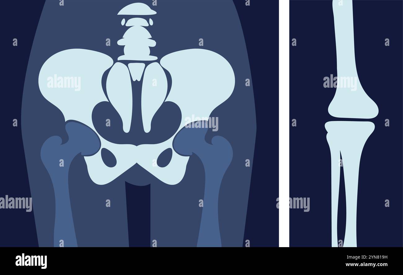 X rays image with bone. Xray of pelvis and knee. Diagnosis and ...